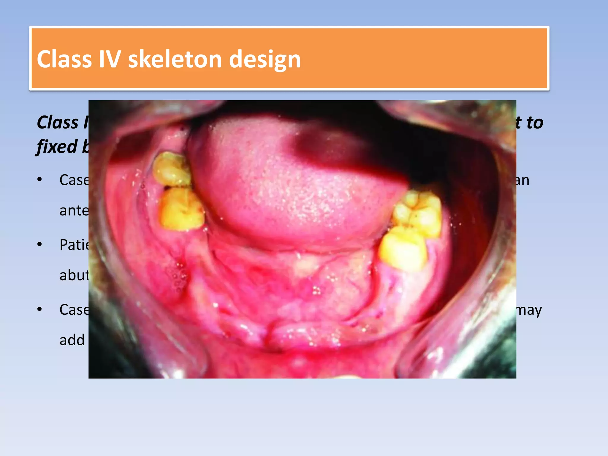 kennedy class IV | PPTX