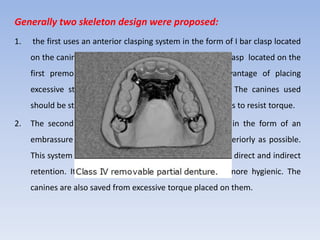 kennedy class IV | PPTX