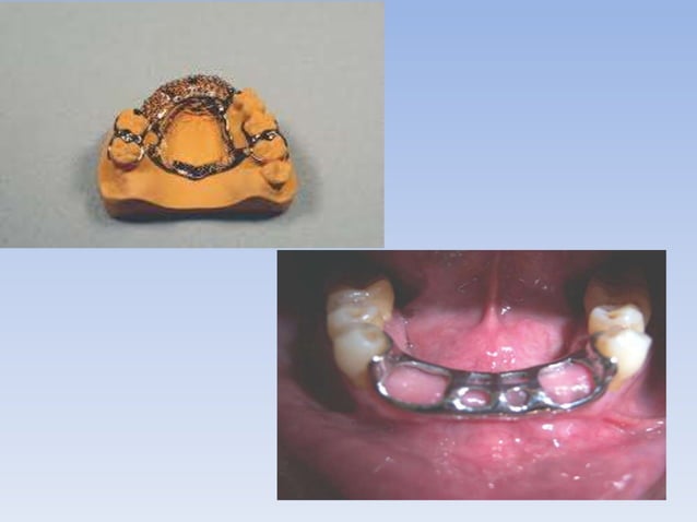 kennedy class IV | PPTX