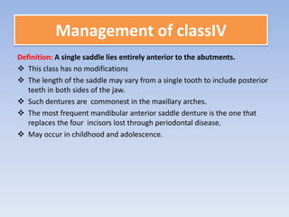kennedy class IV | PPTX