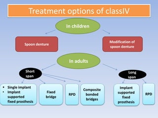 kennedy class IV | PPTX