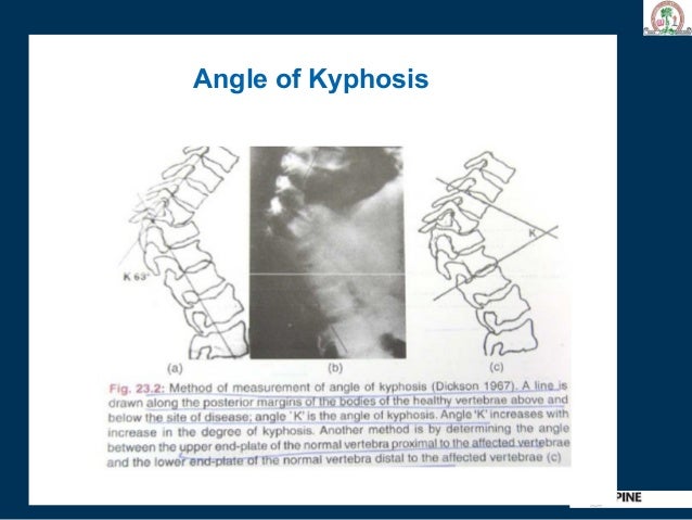 Class lecture tb prof shah alam sir