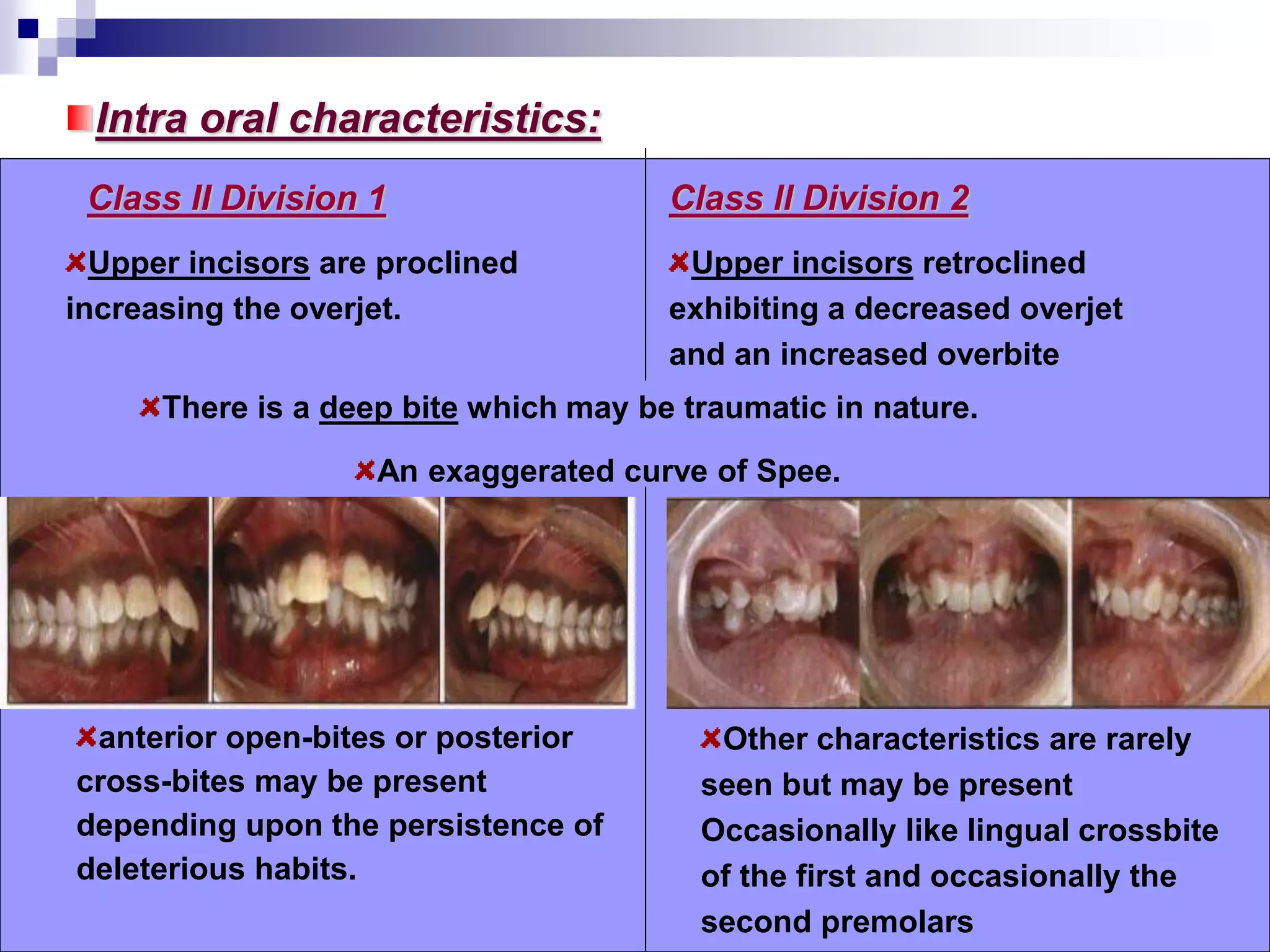 Classll etiology and management | PPT
