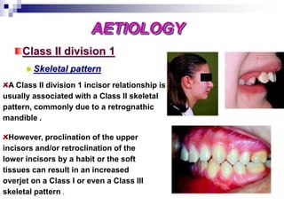 Classll etiology and management | PPT