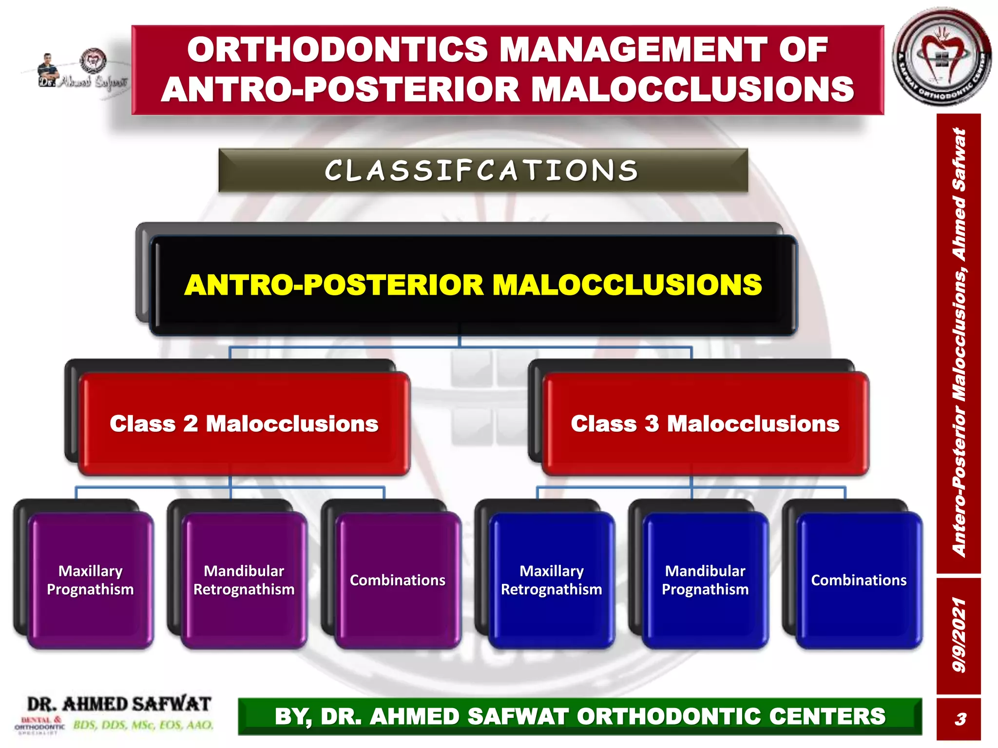 Orthodontic Management of Class ll malocclusion by Ahmed Safwat | PPTX