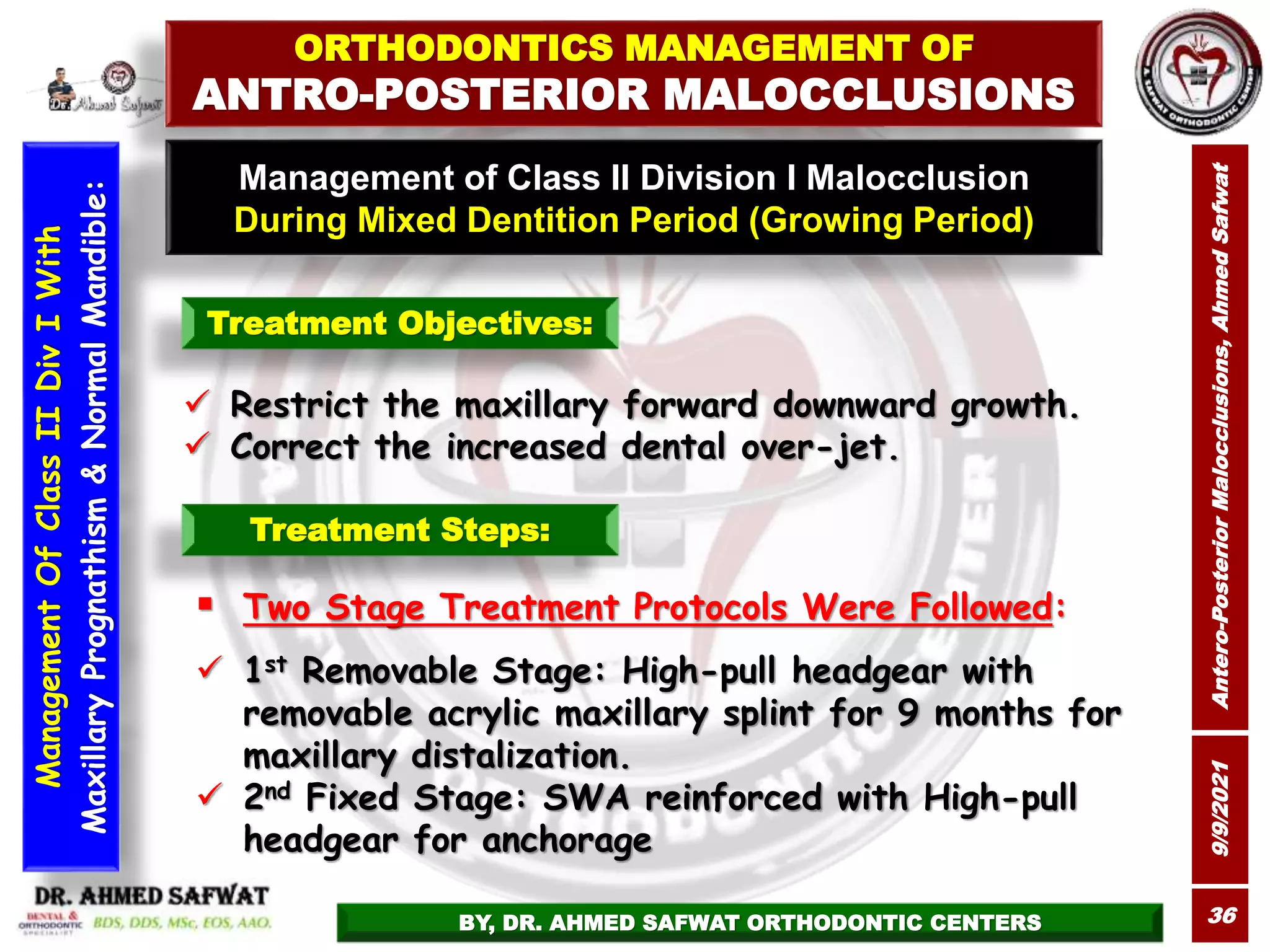 Orthodontic Management of Class ll malocclusion by Ahmed Safwat | PPTX