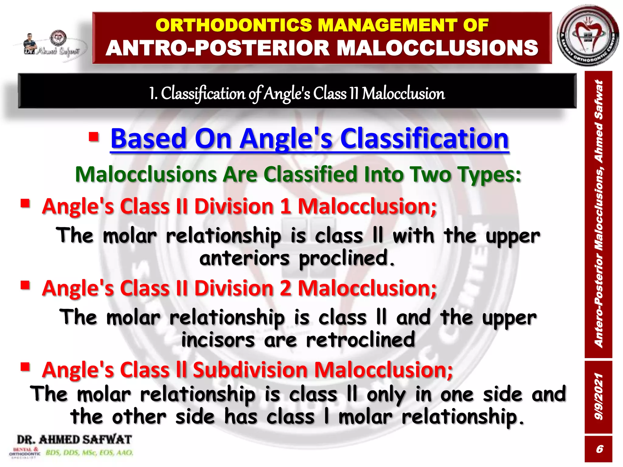 Orthodontic Management of Class ll malocclusion by Ahmed Safwat | PPTX