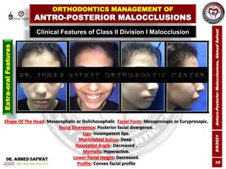 Orthodontic Management of Class ll malocclusion by Ahmed Safwat | PPTX