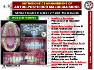 Orthodontic Management of Class ll malocclusion by Ahmed Safwat | PPTX