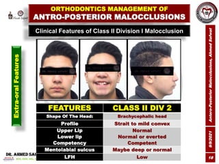 Orthodontic Management of Class ll malocclusion by Ahmed Safwat | PPTX