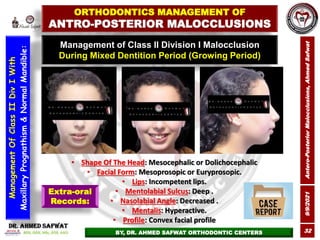 Orthodontic Management of Class ll malocclusion by Ahmed Safwat | PPTX
