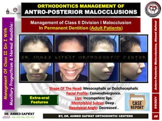 Orthodontic Management of Class ll malocclusion by Ahmed Safwat | PPTX