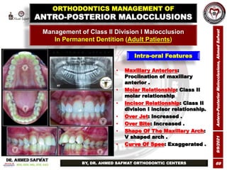 Orthodontic Management of Class ll malocclusion by Ahmed Safwat | PPTX