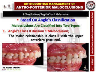 Orthodontic Management of Class ll malocclusion by Ahmed Safwat | PPTX