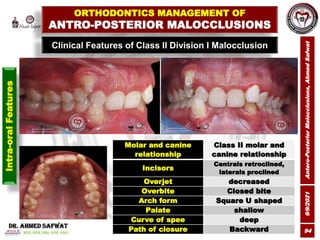 Orthodontic Management of Class ll malocclusion by Ahmed Safwat | PPTX