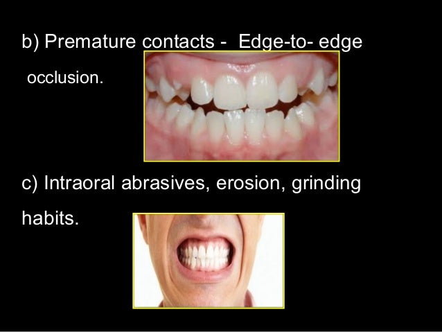 Class on regresive altrations of teeth (RAOT)