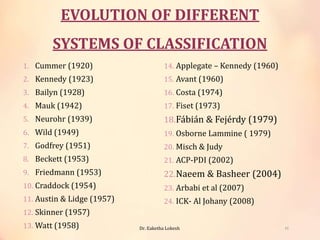 Classification systems for partially edentulous arches | PPTX