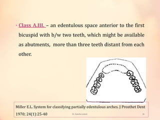 Classification systems for partially edentulous arches | PPTX