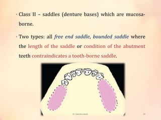 Classification systems for partially edentulous arches | PPTX