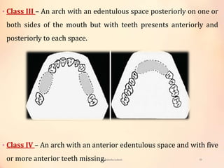 Classification systems for partially edentulous arches | PPTX