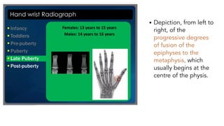 BONE AGE ESTIMATION | PDF