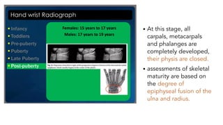 BONE AGE ESTIMATION | PDF