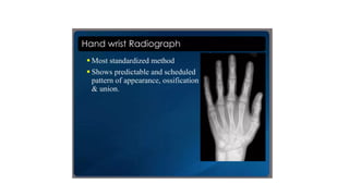 BONE AGE ESTIMATION | PDF