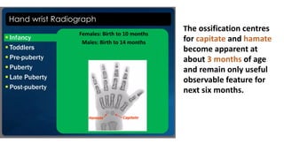 BONE AGE ESTIMATION | PDF