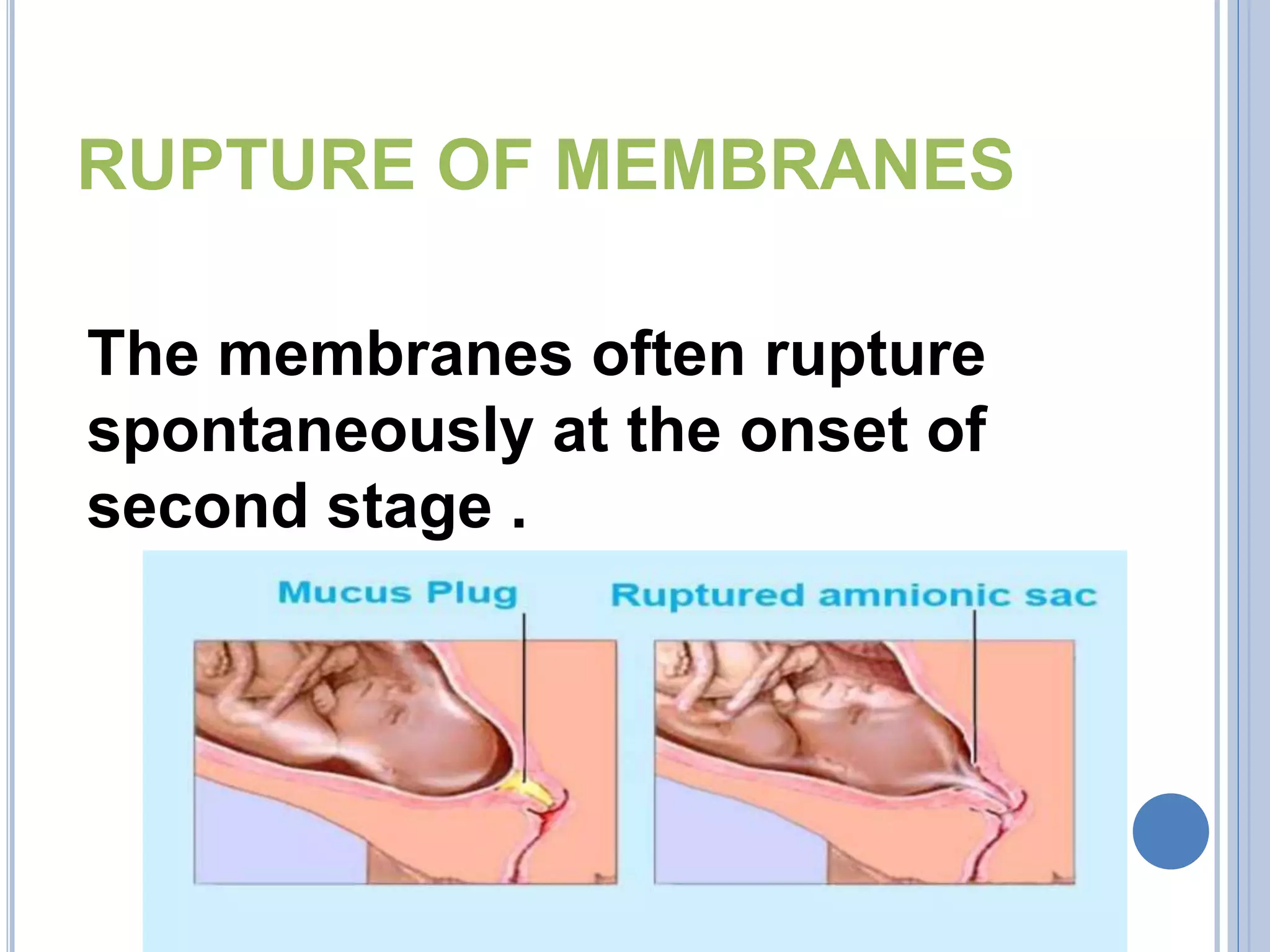 presentation on second stage of labor | PPTX