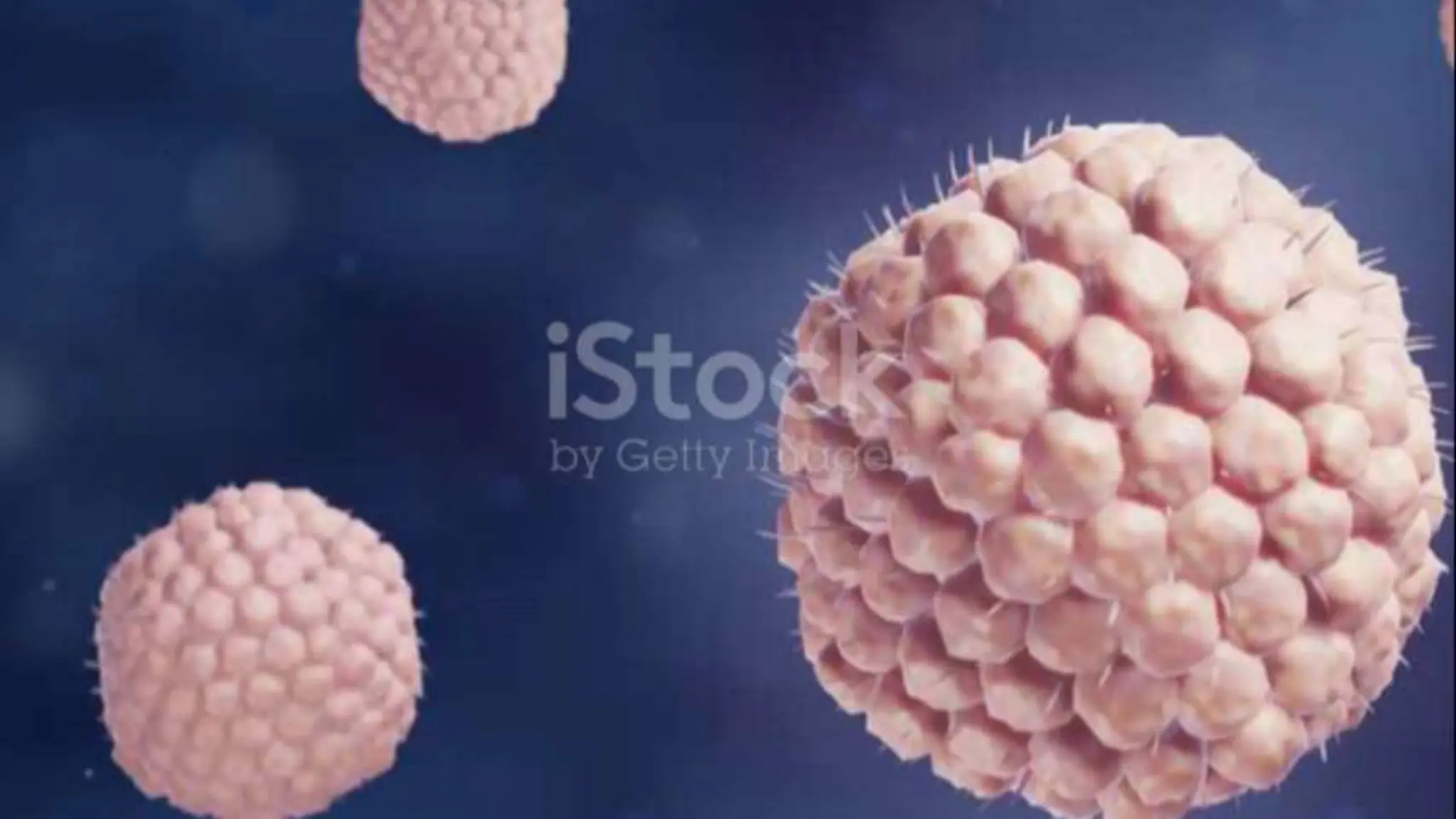 chicken pox and small pox management.pptx