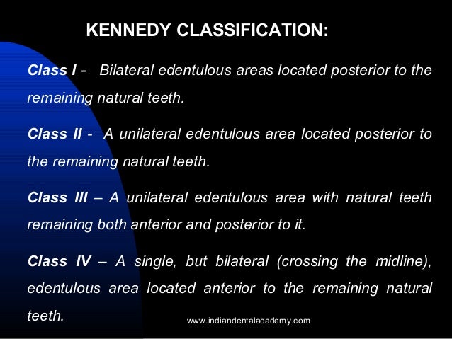 Classification of rpd / dentist laboratory