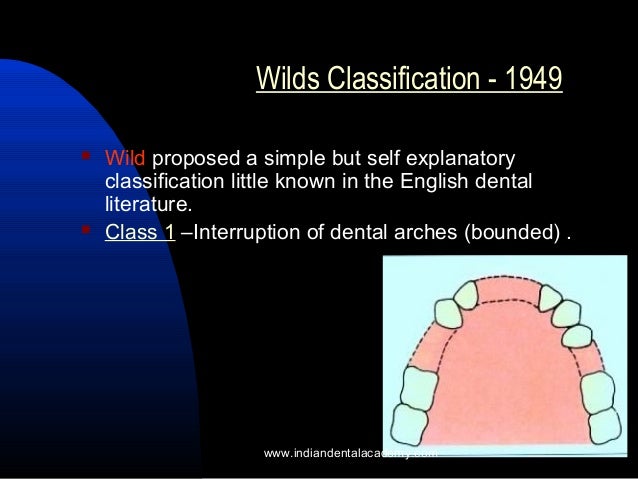 classification system for partially edentulous arches / dental implan…