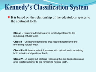 Classsification of rpd | PPT