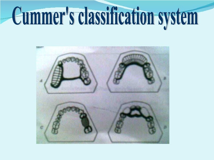 Classsification of rpd