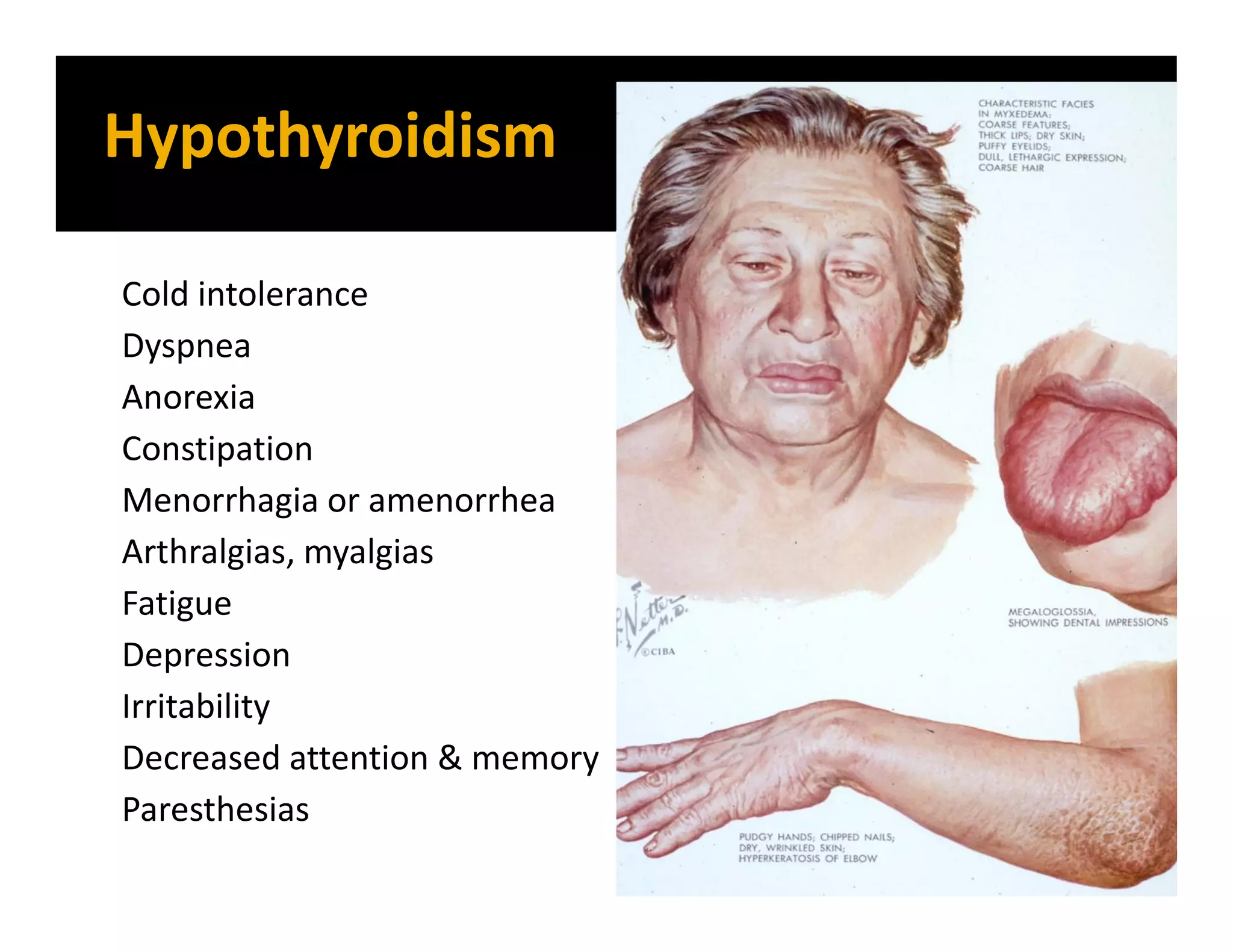 Class thyroid and antithyroid drugs | PDF