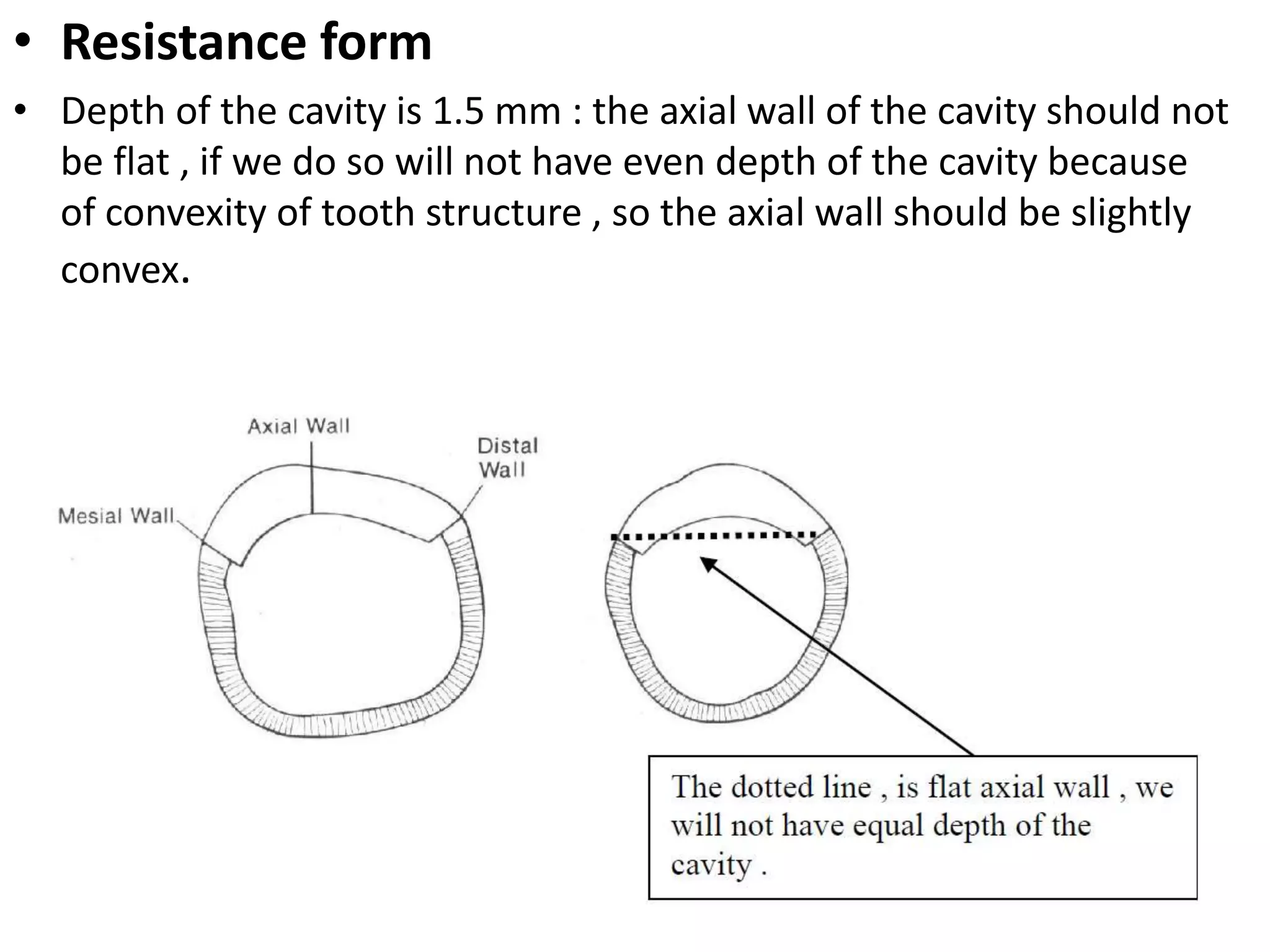 Class V and VI amalgam cavity preparations | PPTX
