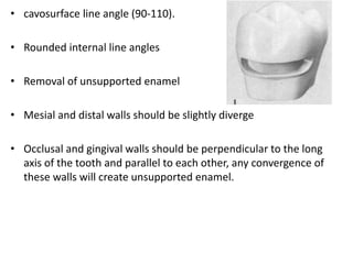 Class V and VI amalgam cavity preparations | PPTX