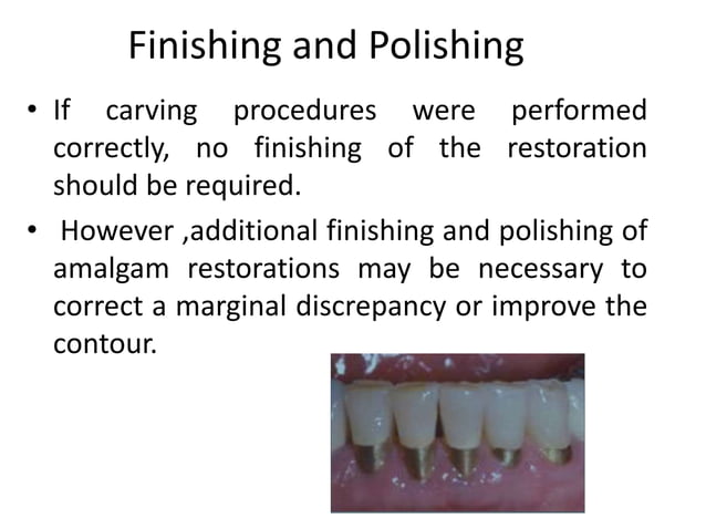 Class V and VI amalgam cavity preparations | PPTX