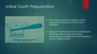 Class v tooth preparation for amalgam restorations | PPTX