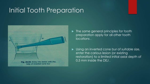 Class v tooth preparation for amalgam restorations | PPTX