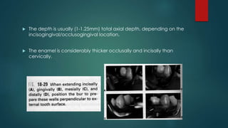Class v tooth preparation for amalgam restorations | PPTX