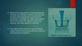 Class v tooth preparation for amalgam restorations | PPTX