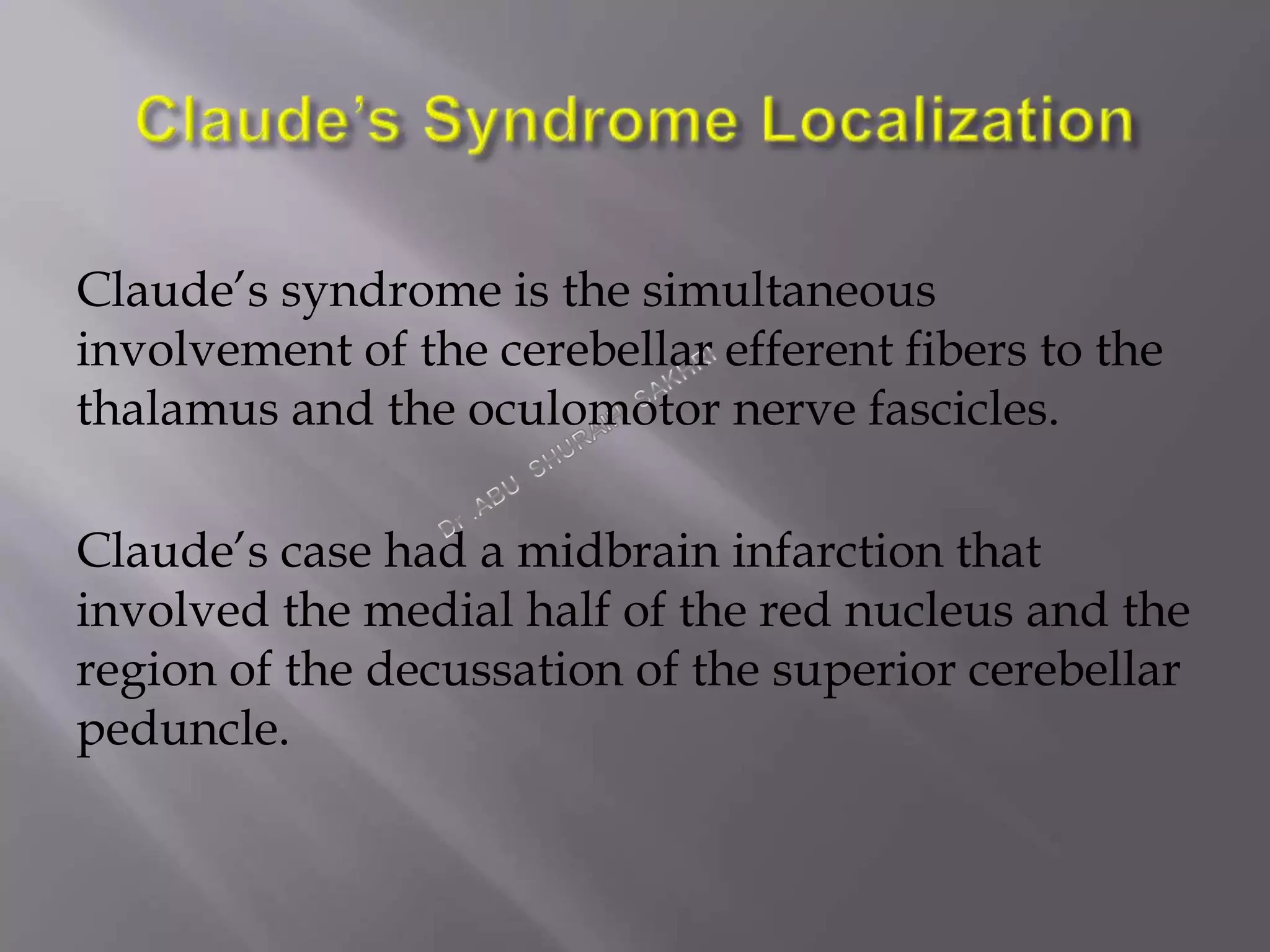 Claudes syndrome | PPT