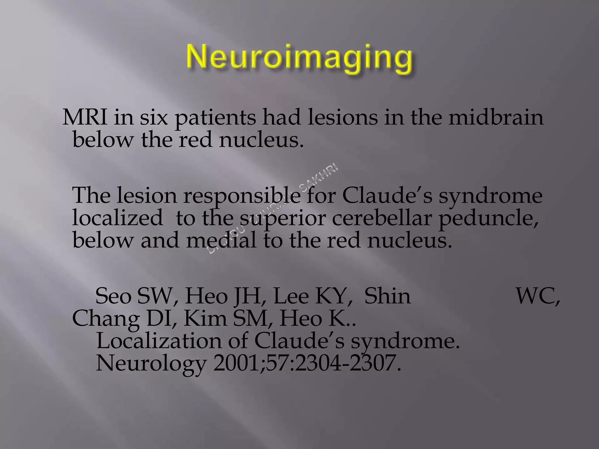 Claudes syndrome | PPT