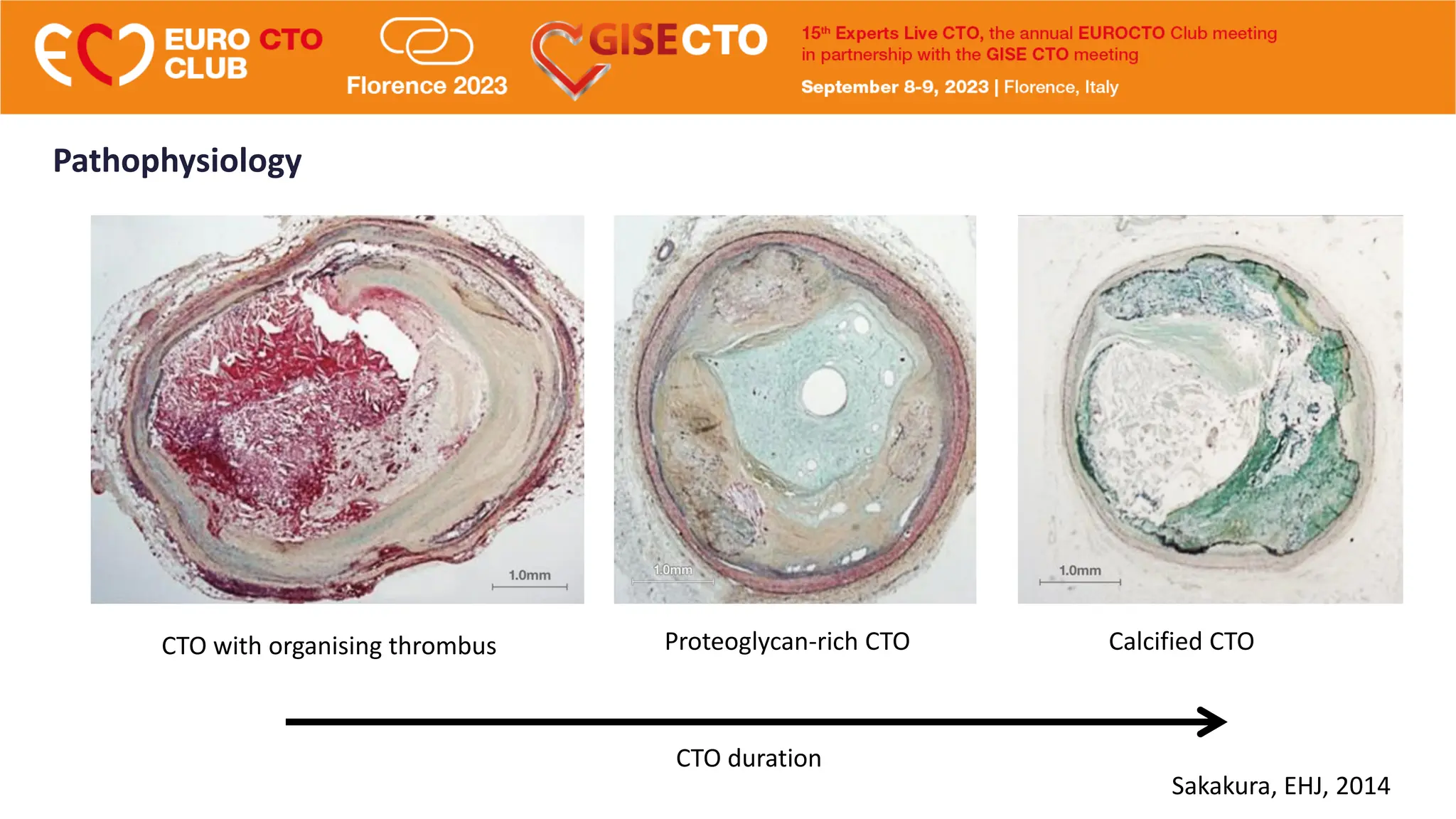 15th Experts Live CTO - Claudia Cosgrove: Calcium and CTO | PPT