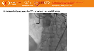 15th Experts Live CTO - Claudia Cosgrove: Calcium and CTO | PPT