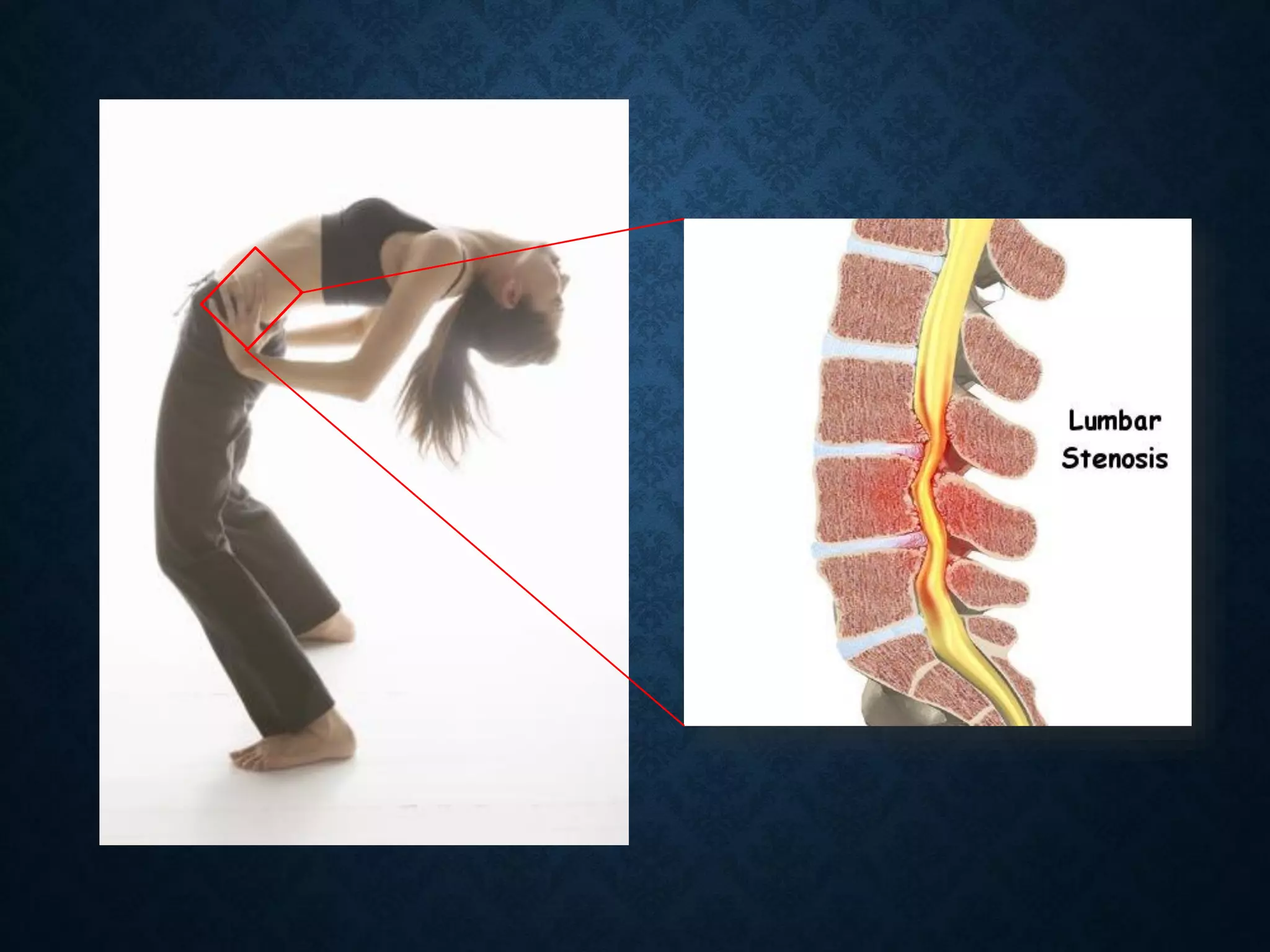 Topic of Vascular Claudication | PDF