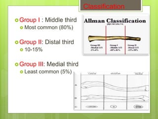 Clavicle Fracture | PPTX