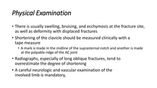 Clavicle Fracture | PPTX