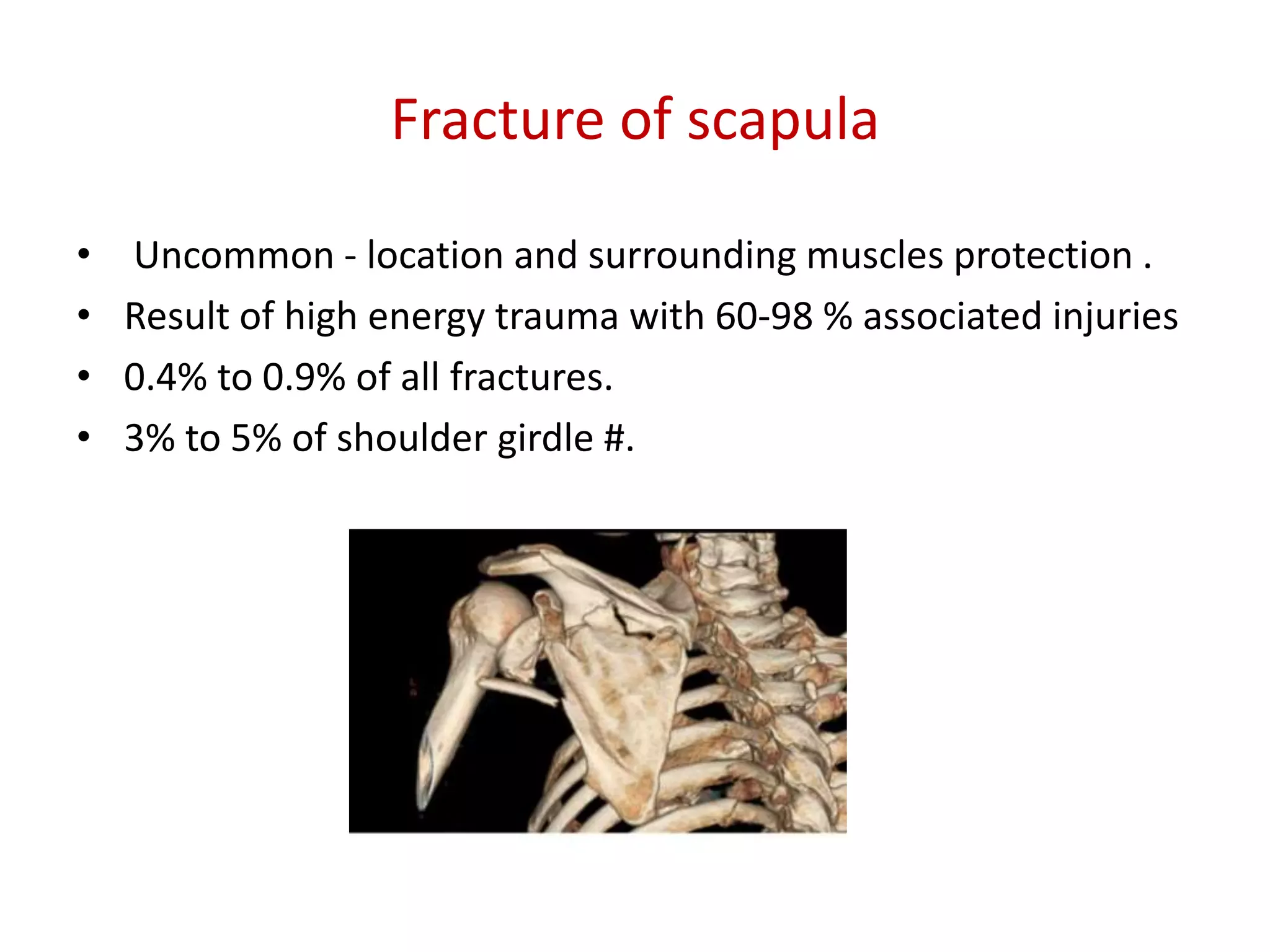 Clavicle and scapular fracture | PPTX